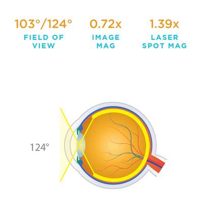 Volk Digital Wide Field® - Couleur Bleu - Ebc